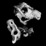 Bonefill - Portal | Bionnovation