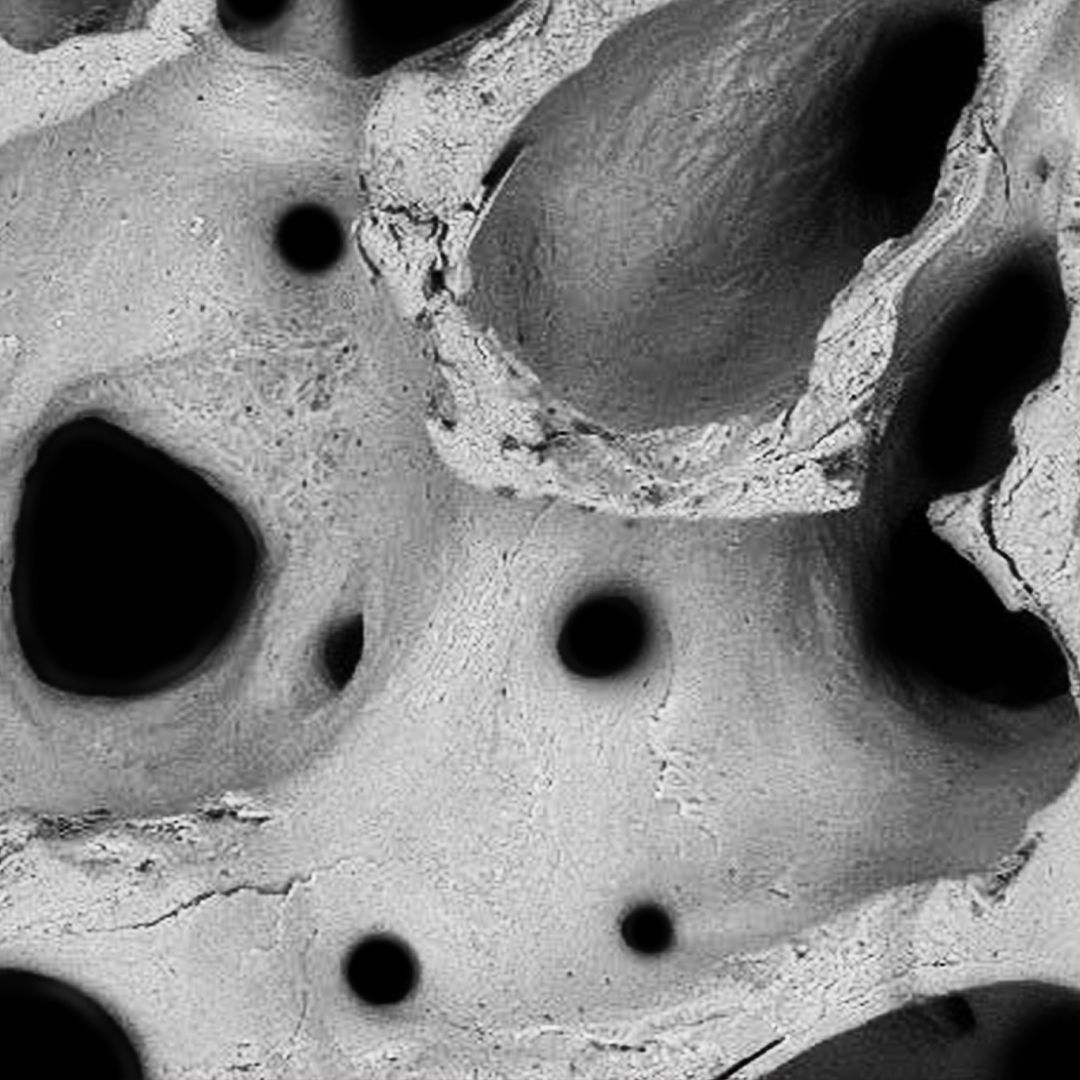 Bonefill Porous Bloco - Bionnovation