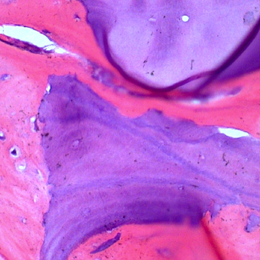 Bonefill Porous Bloco - Bionnovation