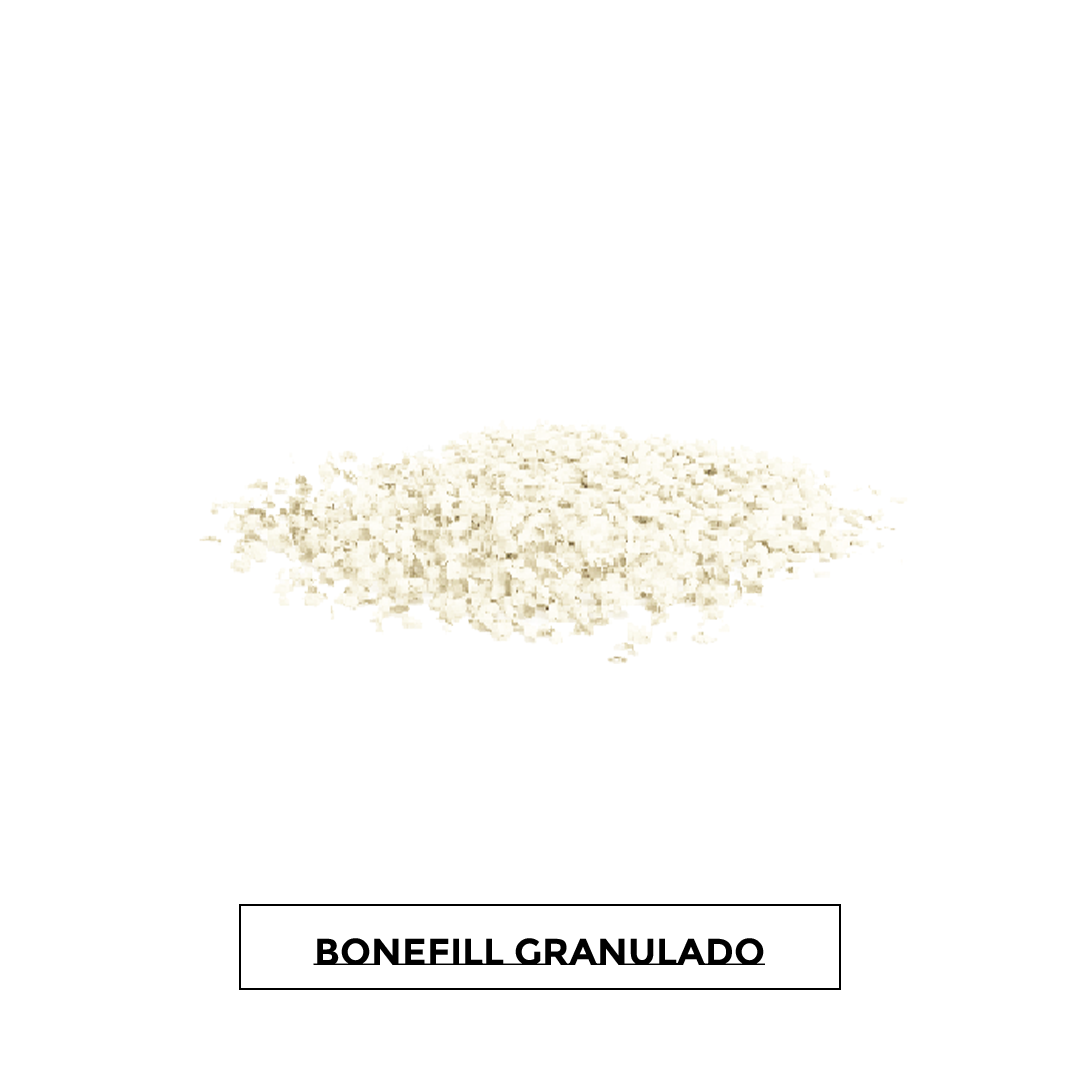 Bonefill - Portal | Bionnovation