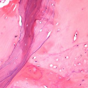 Bonefill - Portal | Bionnovation